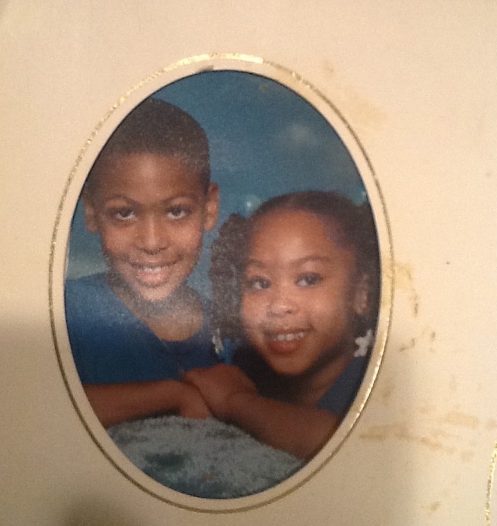 anthony davis before braces