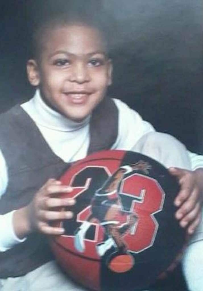 anthony davis before braces