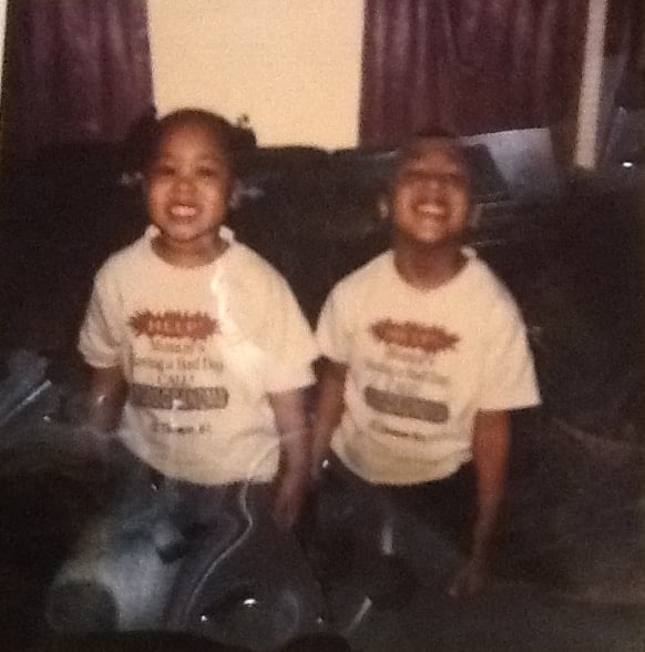 anthony davis before braces